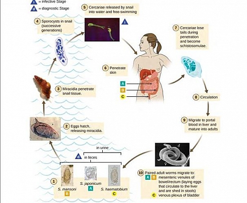 Schistosomiasis (Bilharzia) Symptoms, Life cycle, Transmission, and ...