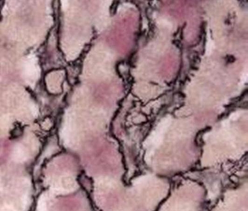 Reticular Connective Tissue: Reticular tissue Function, Fibers ...