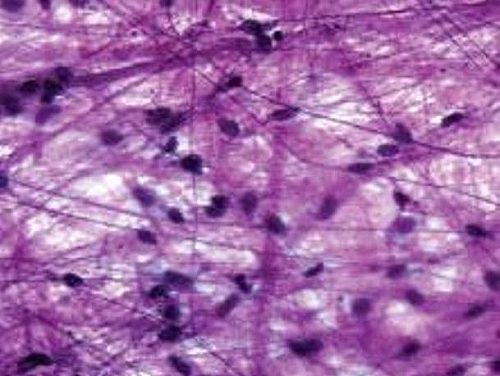 Loose Connective Tissue Function And Examples Jotscroll Loose Connective Tissue Function And Examples Jotscroll