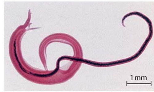 Schistosomiasis (Bilharzia) Symptoms, Life cycle, Transmission, and ...