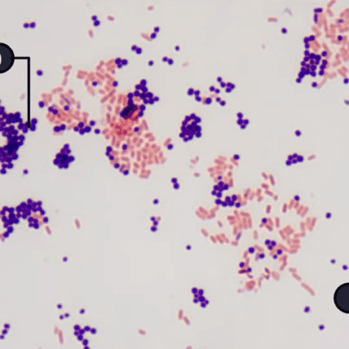 Gram stain procedure: gram staining steps and results in microbiology