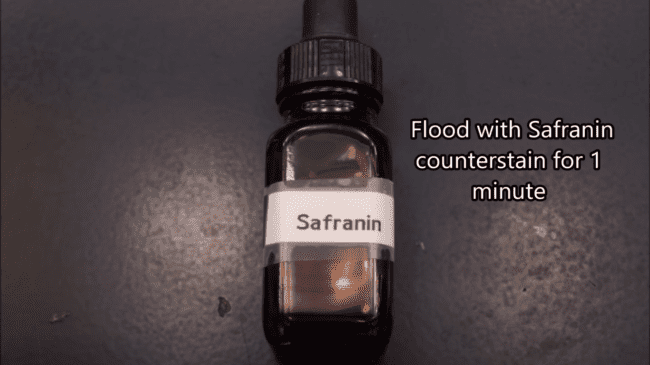 Gram stain procedure: gram staining steps and results in microbiology